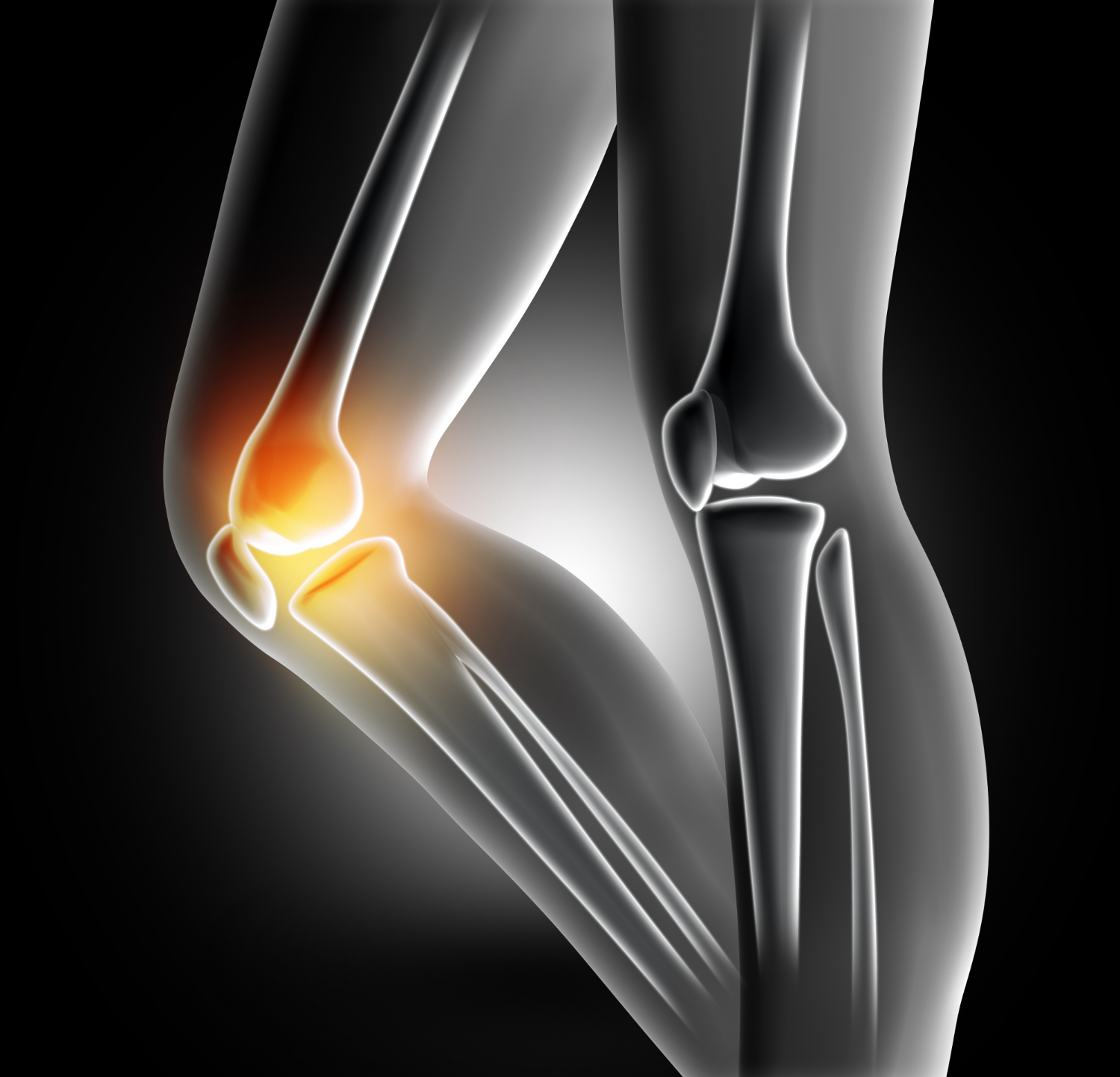 Knee joint | Dr CH Rabin
